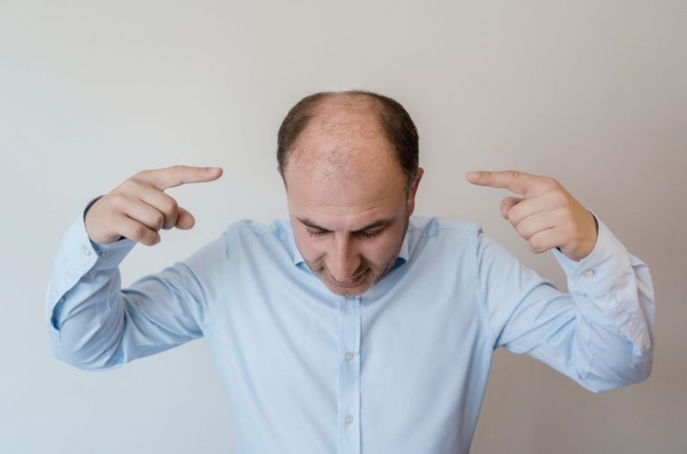 Qué es la tricofobia - PsiquiatrasOnline.com